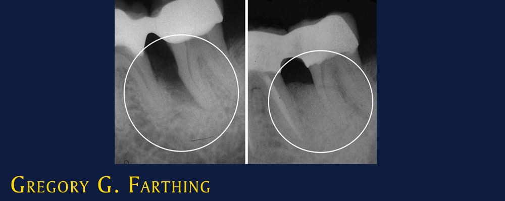 Treatment Gallery Denver CO, Gregory G. Farthing, DDS, MSD, PC